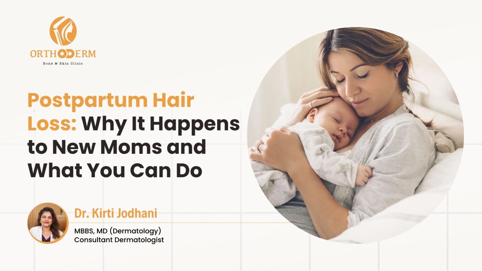 Postpartum Hair Loss: Why It Happens to New Moms and What You Can Do