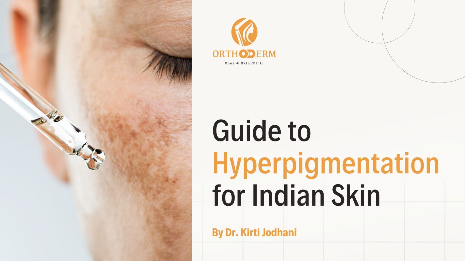 Guide to Hyperpigmentation for Indian Skin | Orthoderm