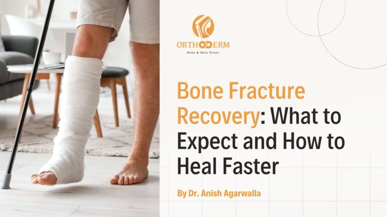 Fracture Recovery: What to Expect and How to Heal Faster