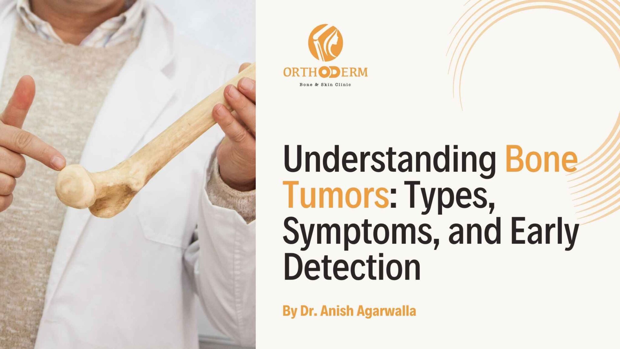 Understanding Bone Tumors: Types, Symptoms, and Early Detection | Orthoderm