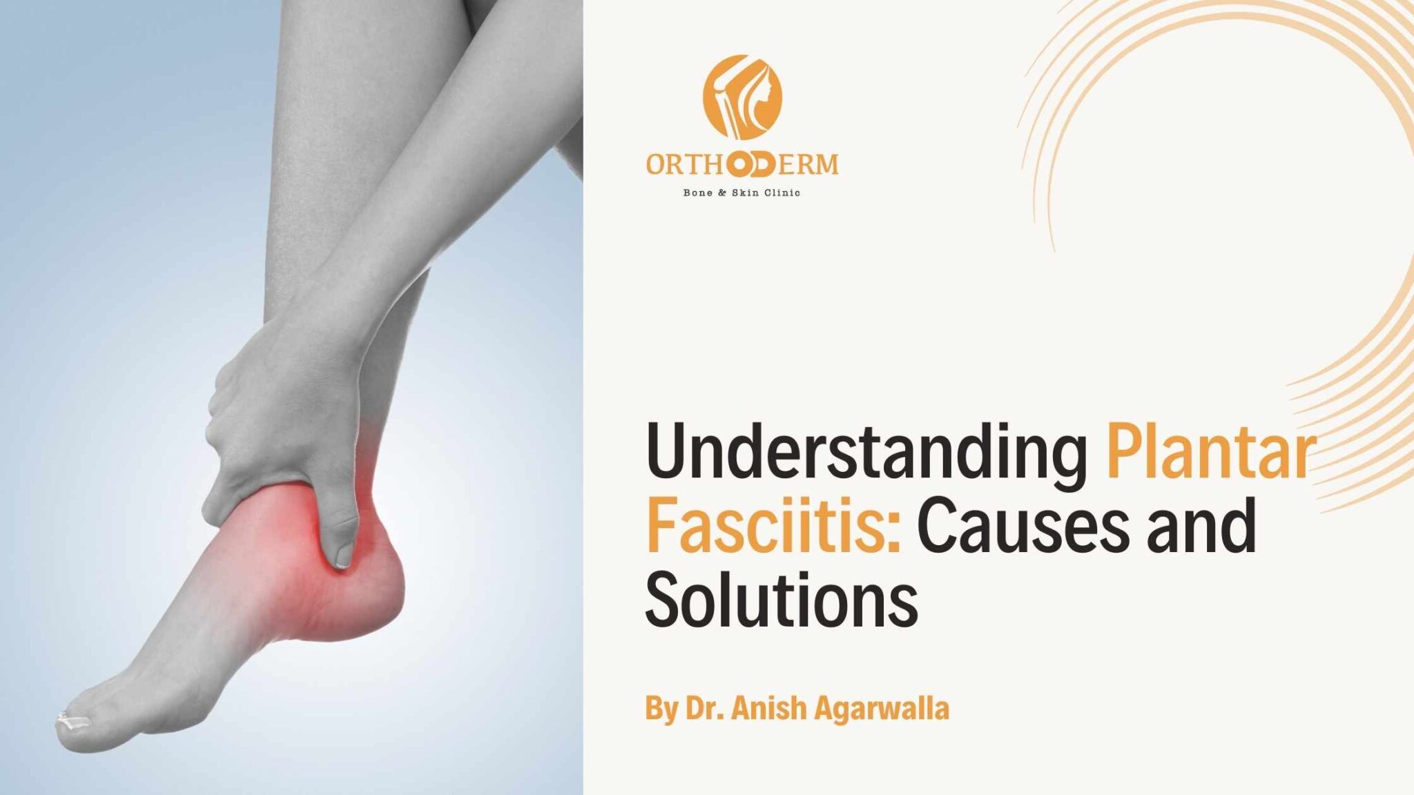 Understanding Plantar Fasciitis: Causes and Solutions | Orthoderm