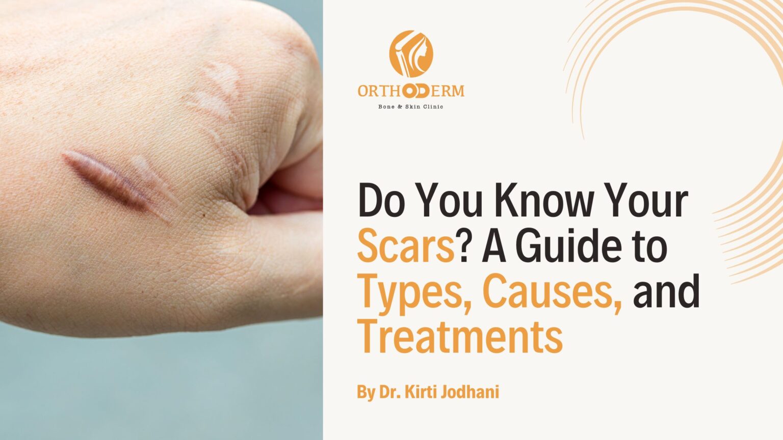 Do You Know Your Scars? Guide to Types, Causes, Treatments